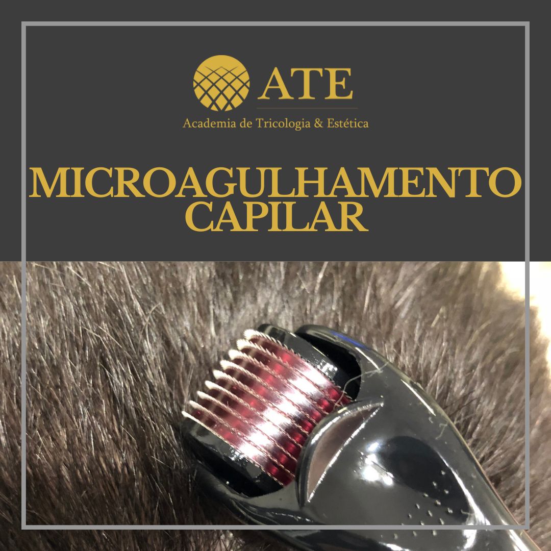 Microagulhamento Capilar - ATE - Academia de Tricologia e Estética ...