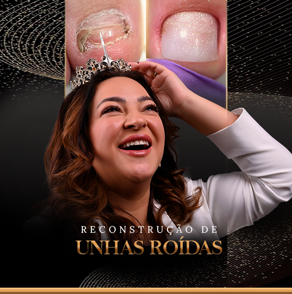 RECONSTRUÇÃO DE UNHAS ROÍDAS - Janaina Rodrigues | Hotmart