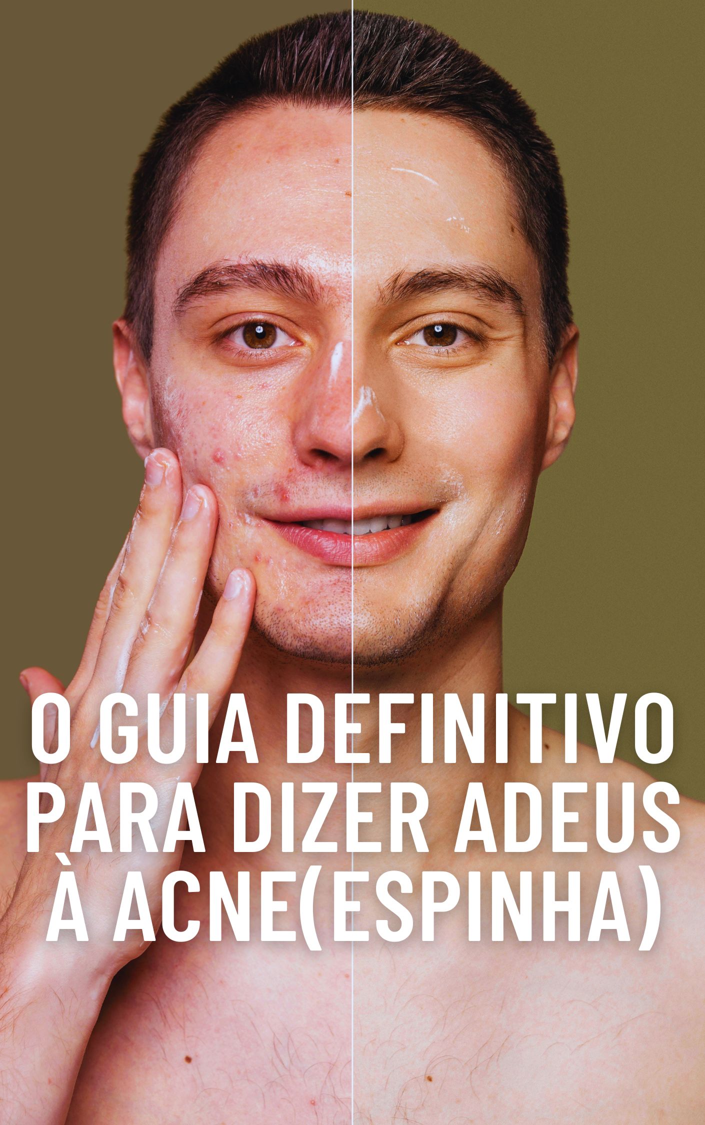 O Guia Definitivo para Dizer Adeus à Acne(espinha) - Sempre Aprende...