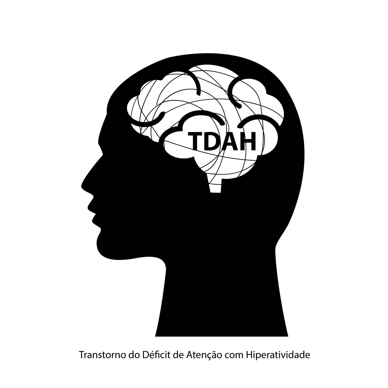 o que é o TDH | Hotmart