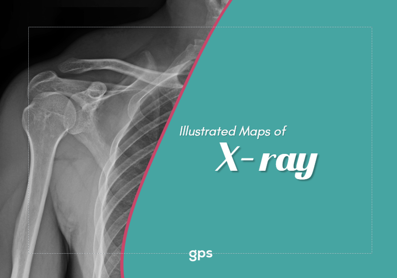 ENG Illustrated Maps of x- ray