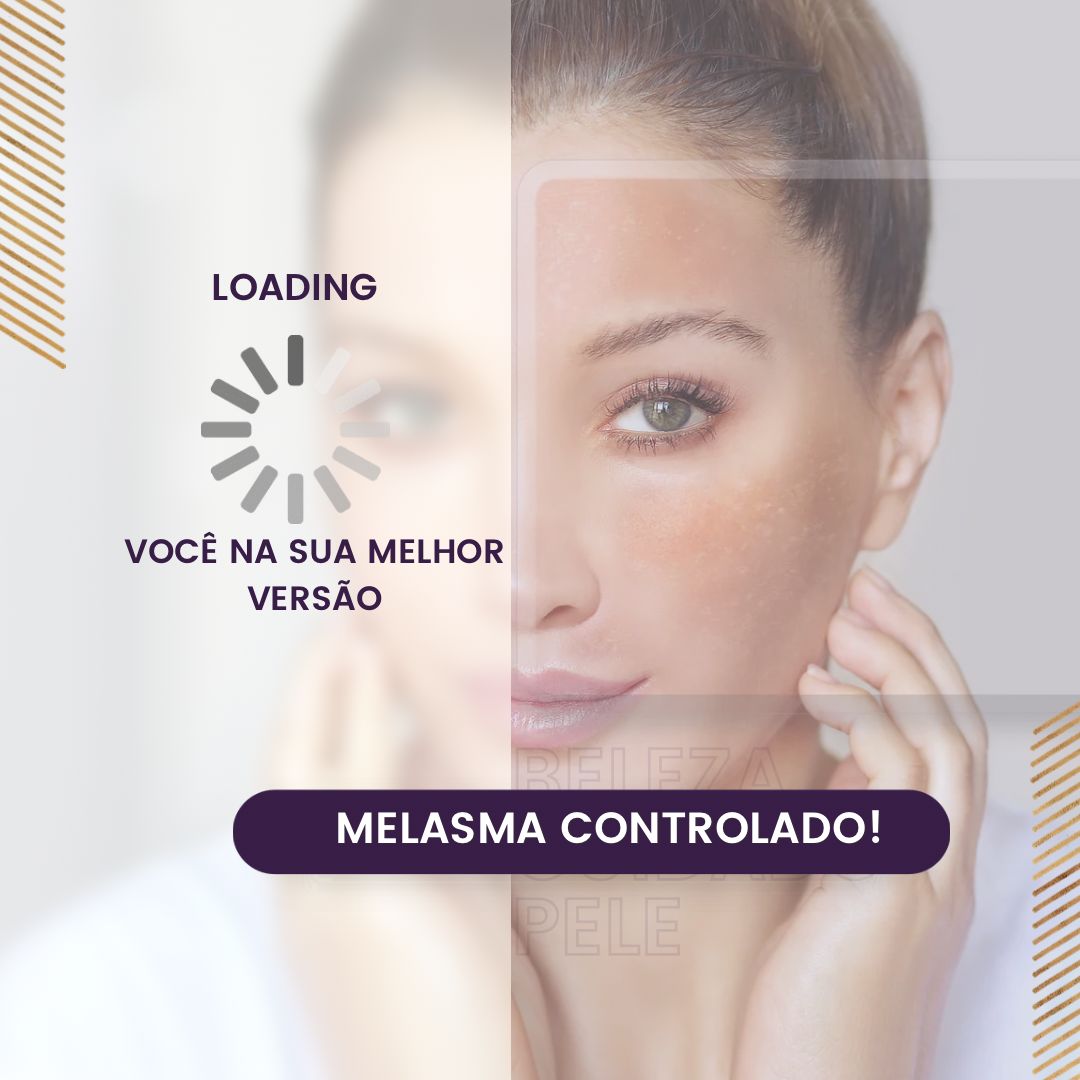 MELASMA CONTROLADO - Diovana Fernandes | Hotmart