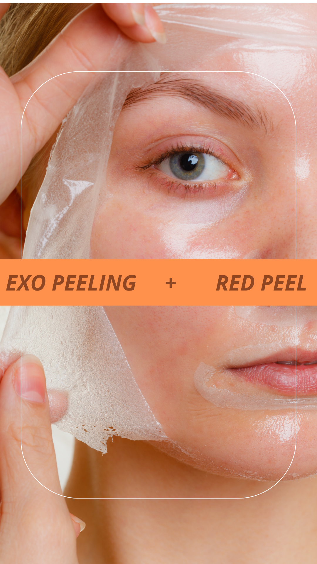 EXO PEELING+RED PEEL