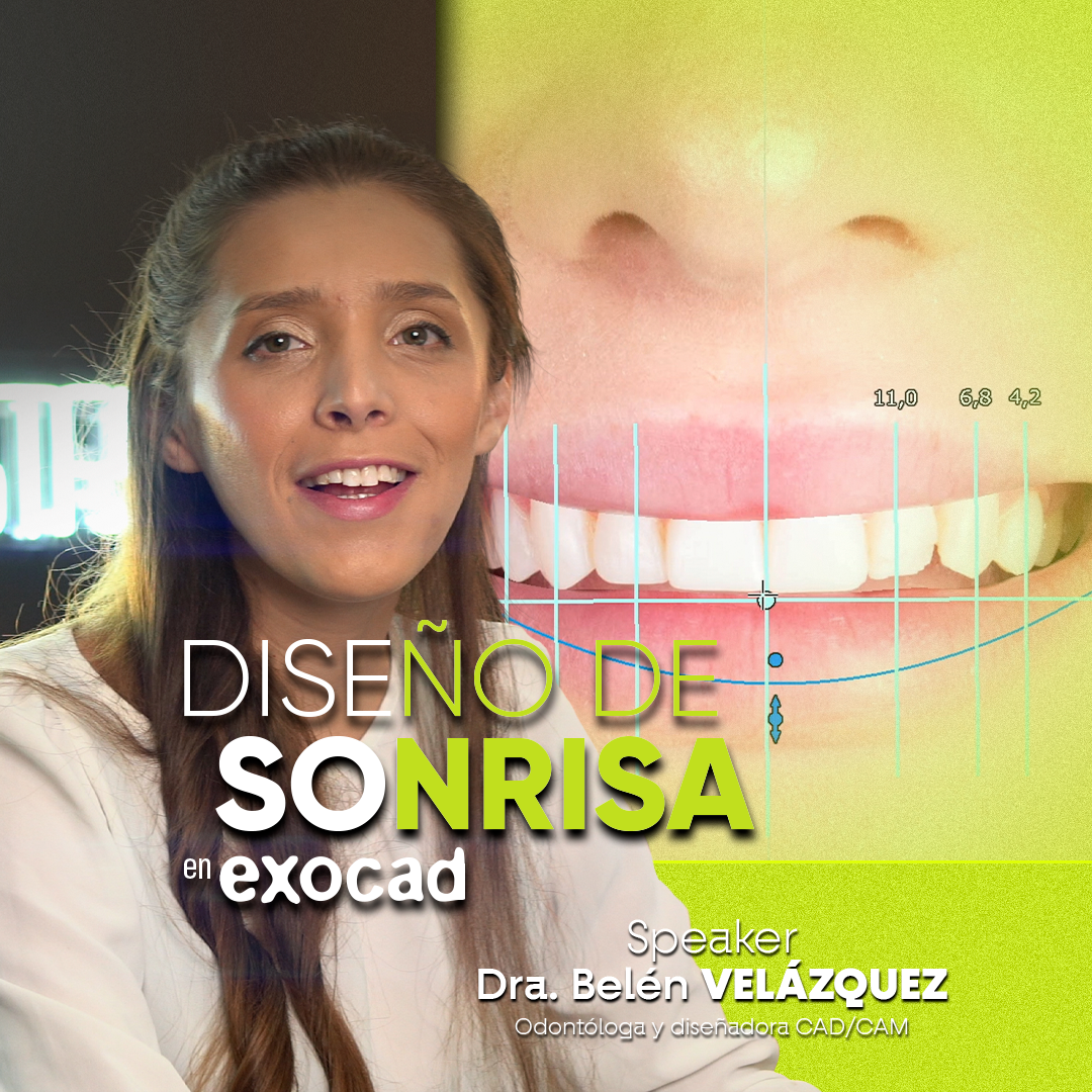 Diseño de Sonrisa en EXOCAD - Digital Dentistry Academy | Hotmart