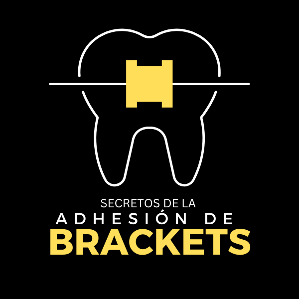 Secretos de la adhesión de brackets - Maria Jullia Inácio | Hotmart