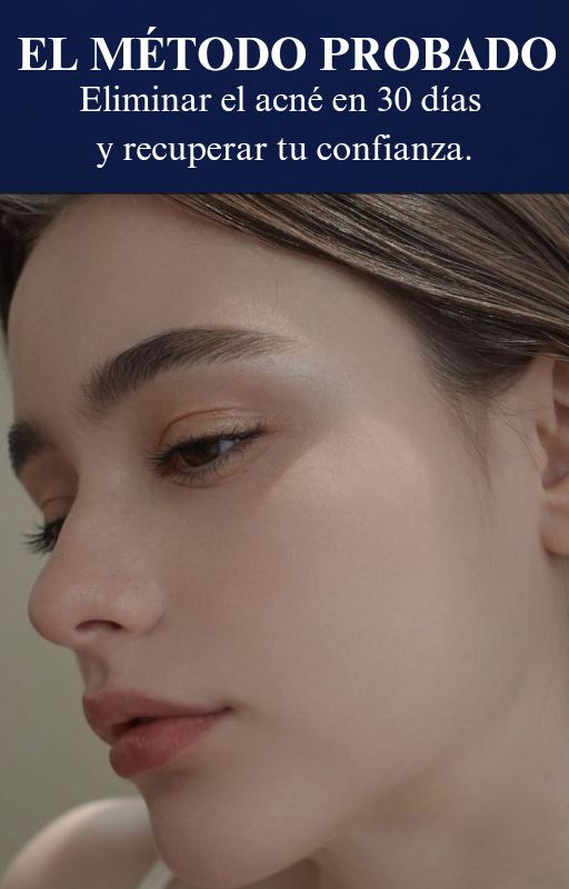 Adiós al Acné: Luce una Piel Perfecta en 30 Días - Emmanuel Hernánd...