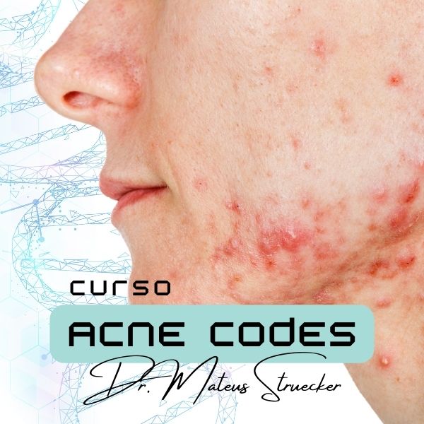 Curso Acne Codes - Acne | Manchas de Acne | Cicatrizes de Acne | Ro...