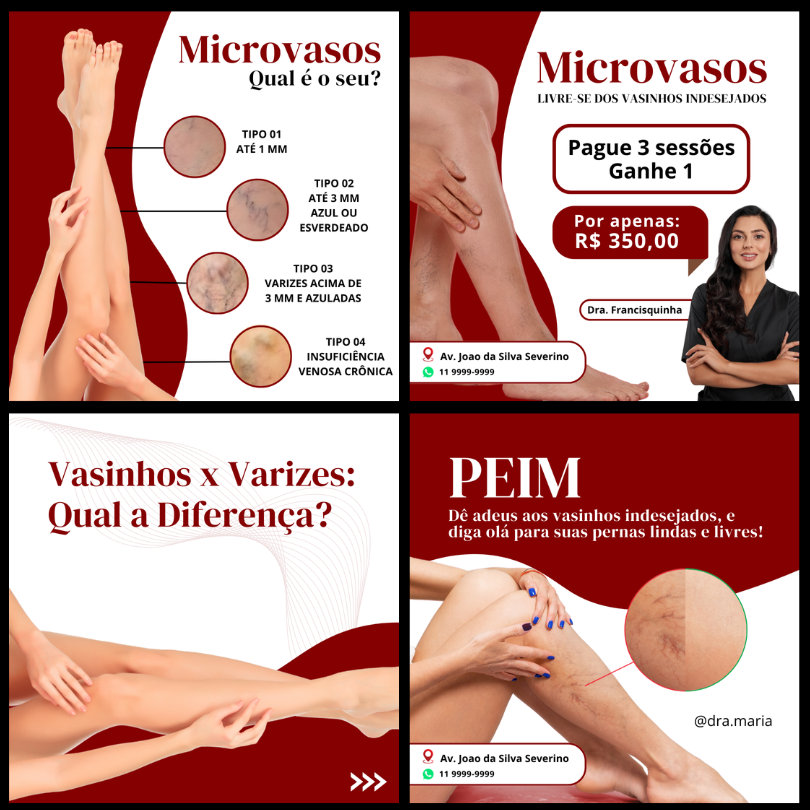 Pack PEIM - Caio Azevedo da Silva | Hotmart