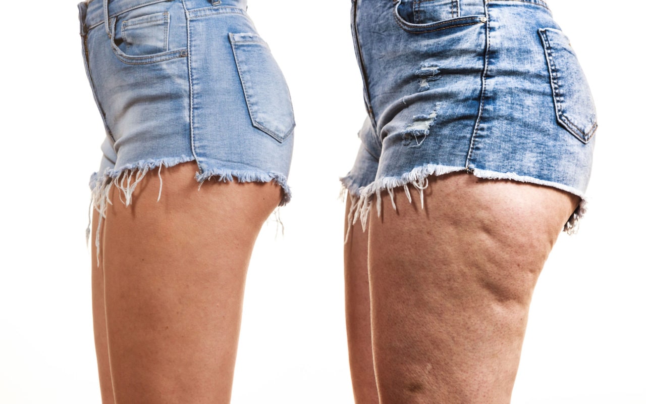 ZERO FLACIDEZ Y CELULITIS - Izidine Ambasse | Hotmart