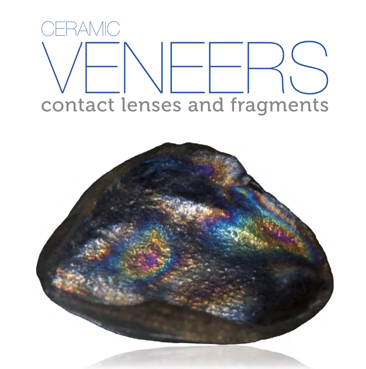 Ceramic Veneers: Contact Lenses and Fragments
