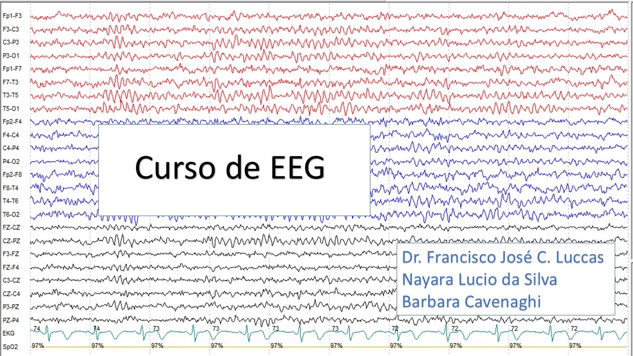 Curso de EEG