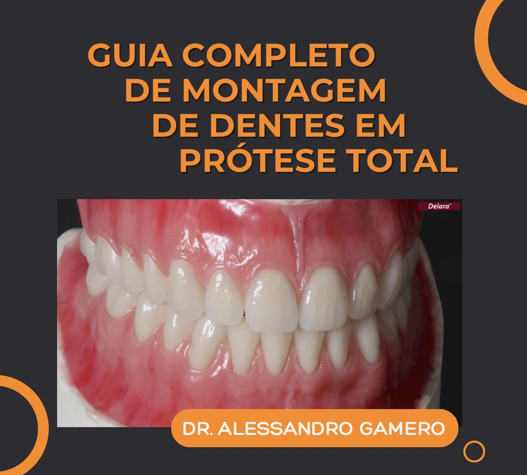 Guia completo de montagem de dentes para prótese total - Alessandro...