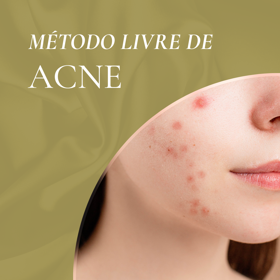 Método Livre da Acne - Arthur Fernando Steffens Zanoni | Hotmart