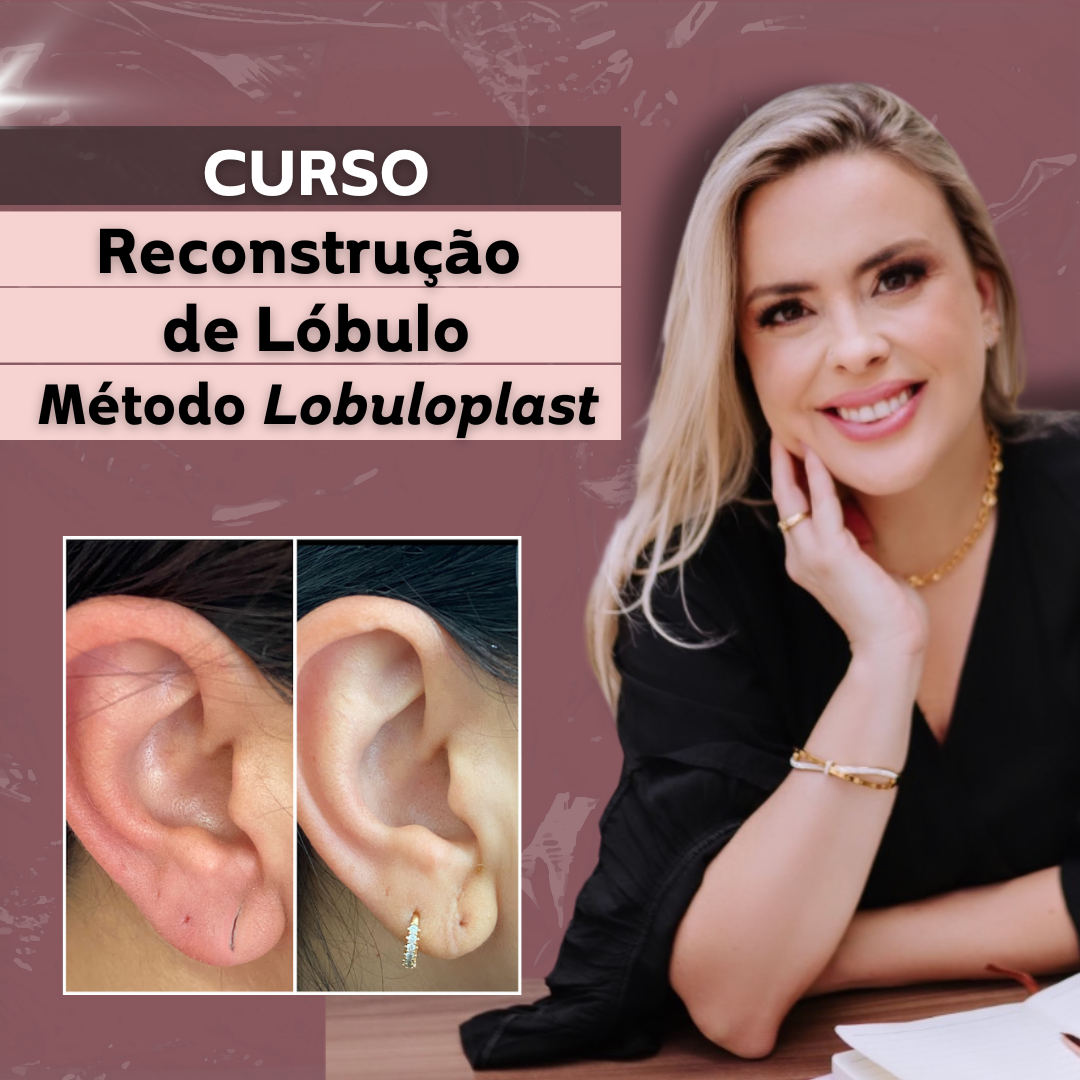 Reconstrução de Lóbulo - Método Lobuloplast