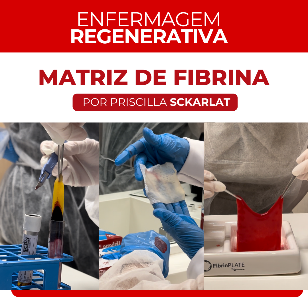 Curso de Matriz de Fibrina para Enfermeiros - Priscilla Sckarlat de...