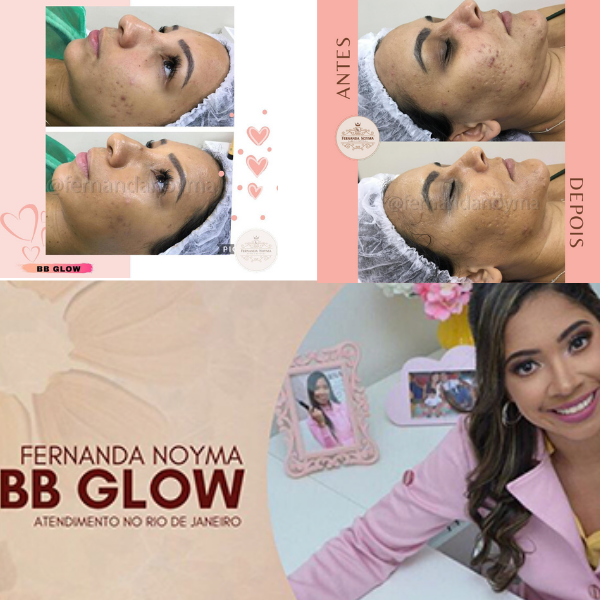 Curso de BBGLow Online - Studio Fernanda Noyma | Hotmart