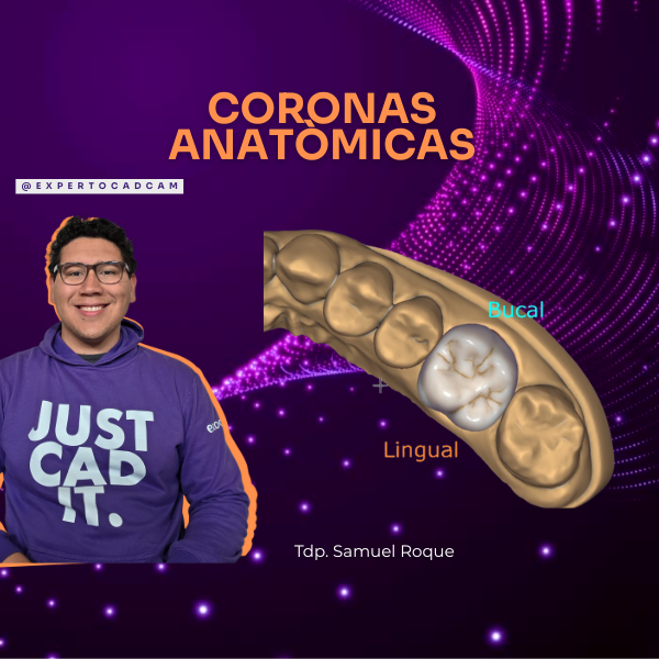 Diseña una corona anatómica en Exocad - Samuel Roque | Hotmart