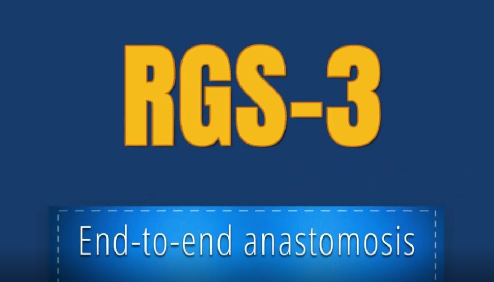 RGS3 - END TO END ANASTOMOSIS