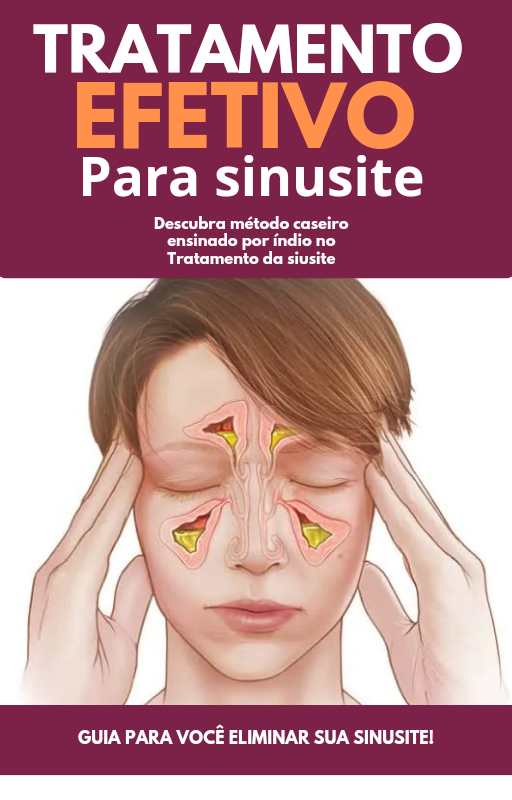 TRATAMENTO EFETIVO PARA A SINUSITE - Thiago de Souza Gomes | Hotmart