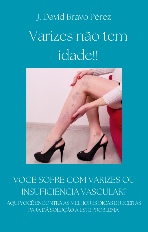 Varizes não tem idade, como preveni-las? - Jefferson David Bravo Pe...