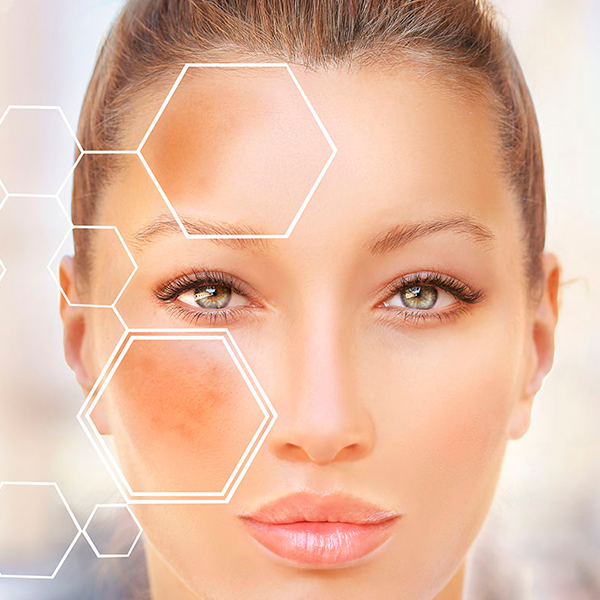 PIEL SIN MANCHAS - João Pedro de Araújo | Hotmart