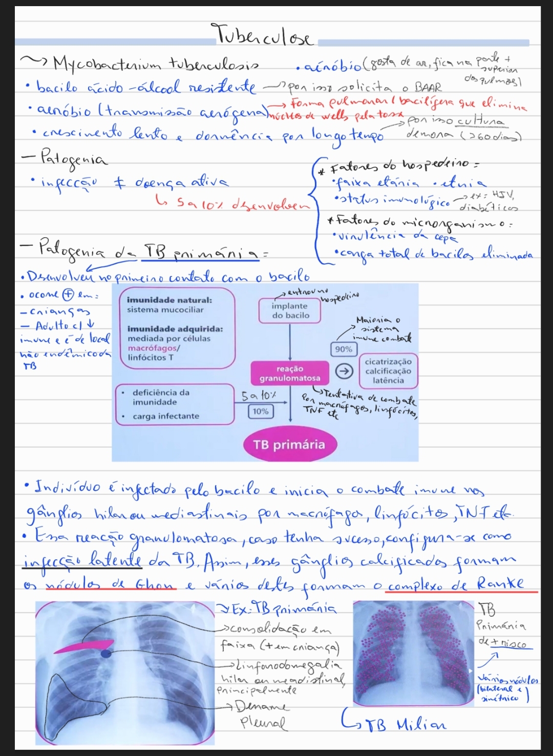 Resumo Tuberculose - Resumosmed | Hotmart