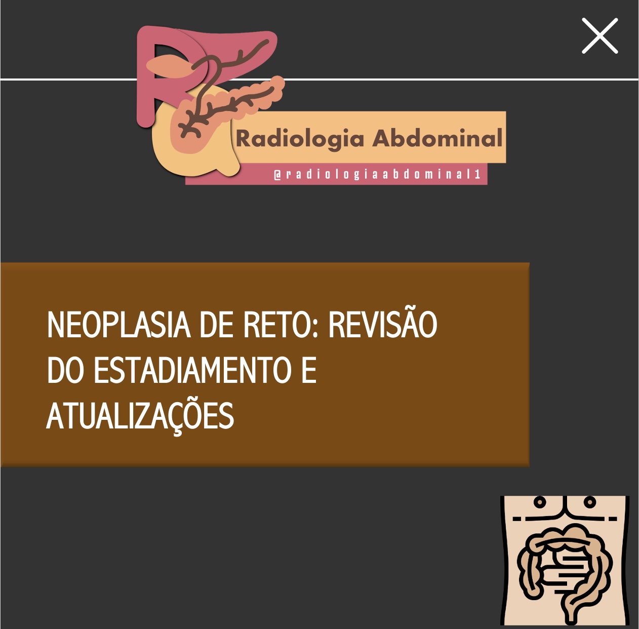 NEOPLASIA DE RETO: REVISÃO DO ESTADIAMENTO E ATUALIZAÇÕES - ITALO R...