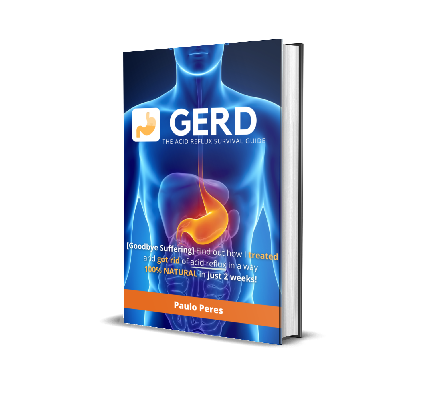 GERD - The Acid Reflux Survival Guide
