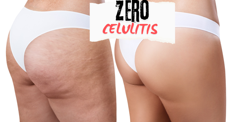 ZERO CELULITIS - Carlos alberto benjamim nhamposse | Hotmart