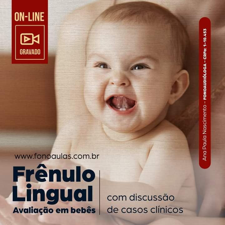 A AVALIAÇÃO DO FRÊNULO LINGUAL EM BÊBES - Ana Paula Almeida do Nasc...