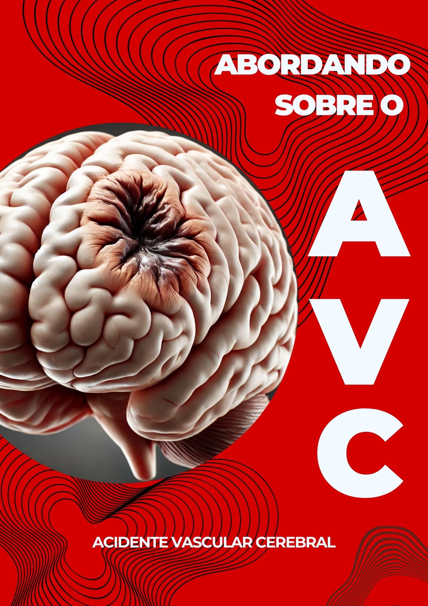 Abordando sobre o AVC - Acidente Vascular Cerebral - Beatriz Reis ...