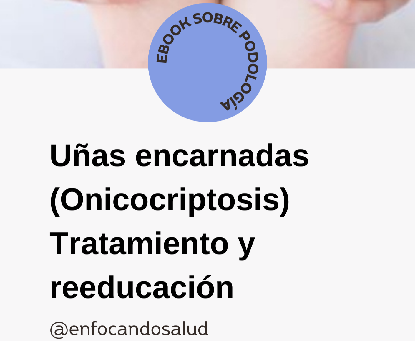 Onicocriptosis (uñas encarnadas) tratamiento y reeducación - Maria...