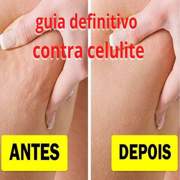 guia definitivo contra celulite. - Carlos Henrique Almeida | Hotmart
