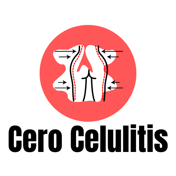 Cero Celulitis - Tiago Cunha de Castro miranda | Hotmart