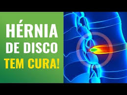 Curso Protocolo de Tratamento para Hérnia de Disco - Adriano Amaral...