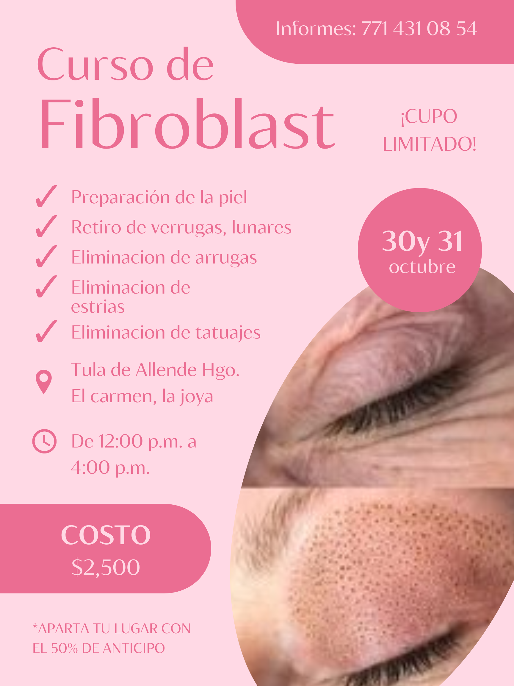 Curso Fibroblast - Valeria Elizabeth Ascencio Ortega | Hotmart