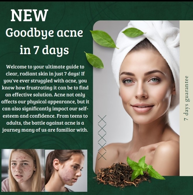 Goodbye Acne in 7 Days