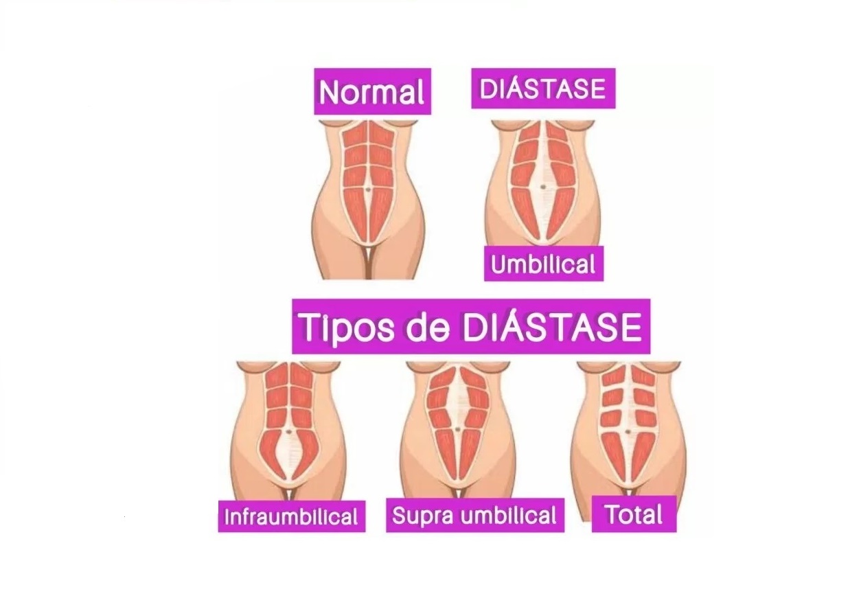 Programa Barriga Sarada