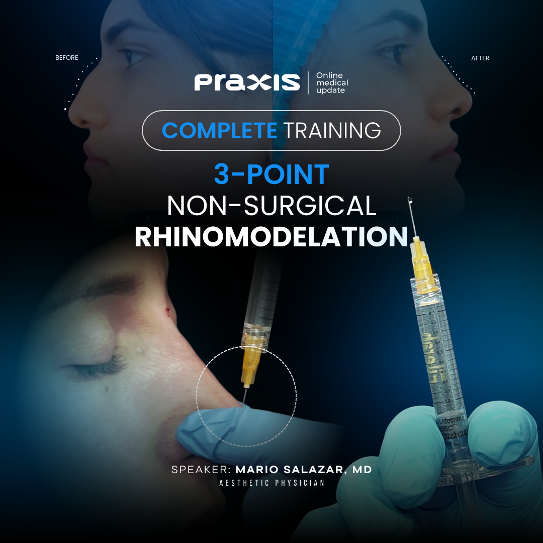 Three-Point Technique for Non-Surgical Rhinomodeling - Praxis Studi...