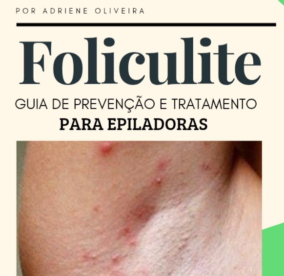 O GUIA DE PREVENÇÃO E TRATAMENTO PARA FOLICULITE NA EPILAÇÃO COM CE...