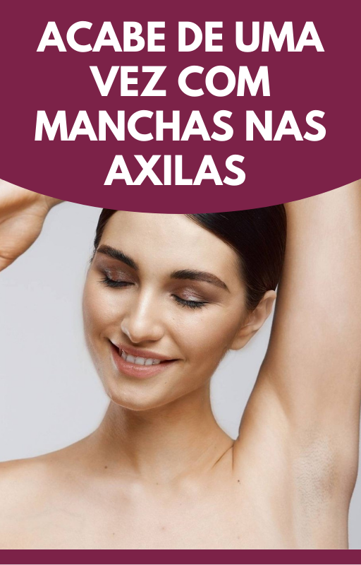 Acabe de uma vez com manchas nas axilas - Alisson Alexandre Ferrei...