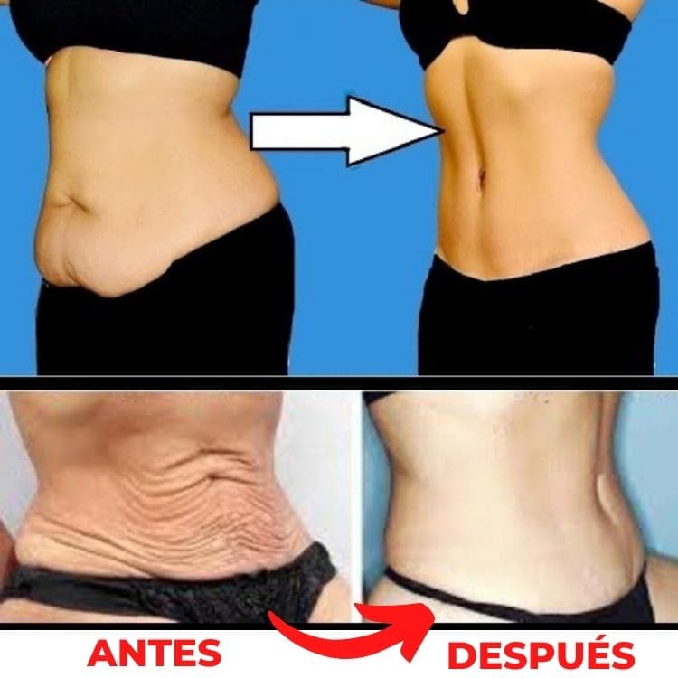 ZERO FLACIDEZ Y CELULITIS - Flora Adriano Michel | Hotmart