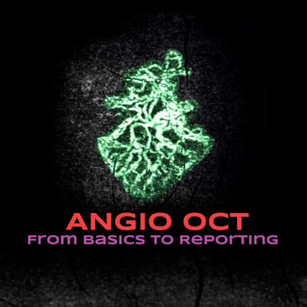 Angio OCT - from basics to report - Orbit | Hotmart