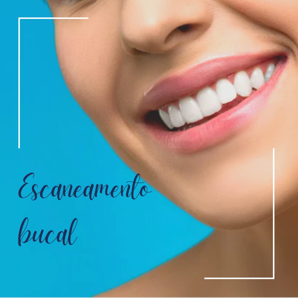 Escaneamento Bucal - Tiago Gil | Hotmart