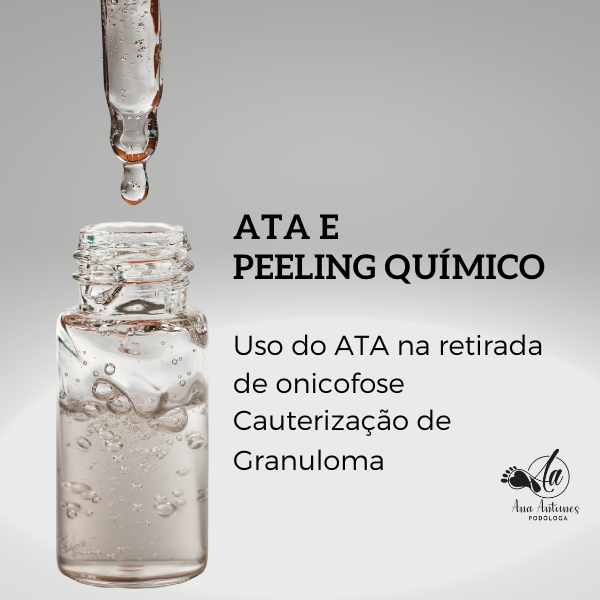 Ata - Peeling Químico - Ana Antunes | Hotmart