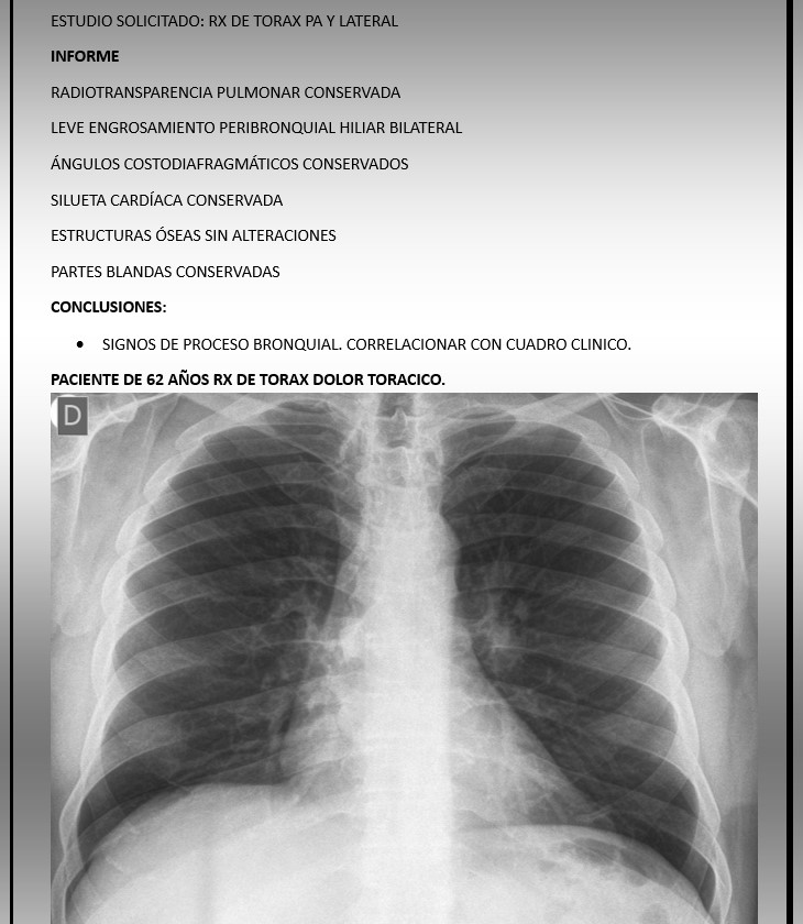 Radiografías de Tórax Informadas – Casos Clínicos Reales (Volumen 1...
