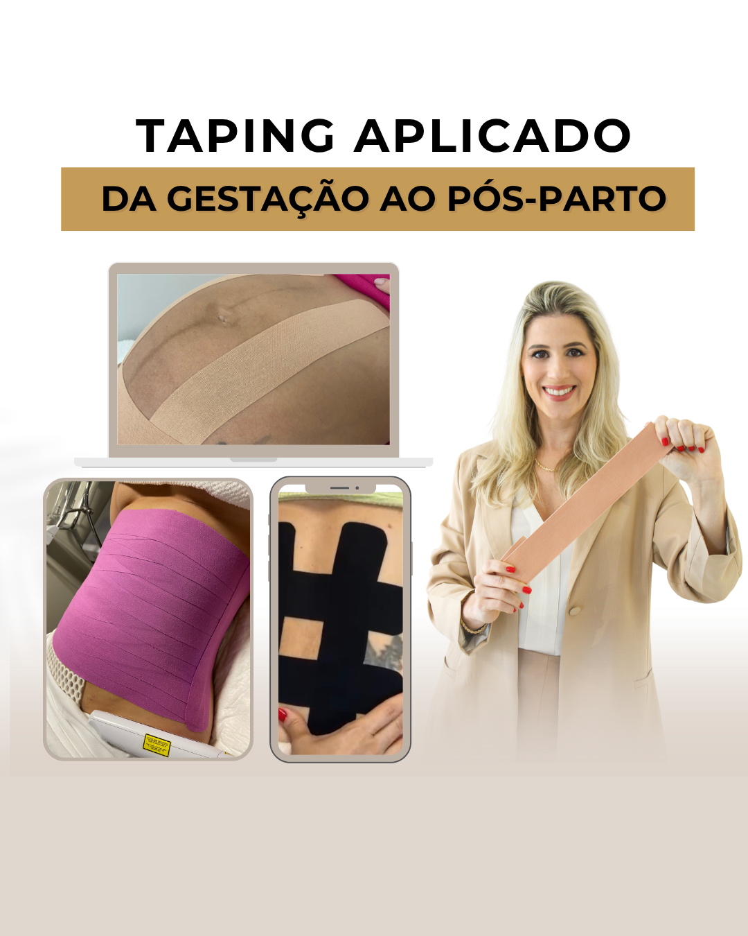 Taping da Gestação ao Pós-Parto