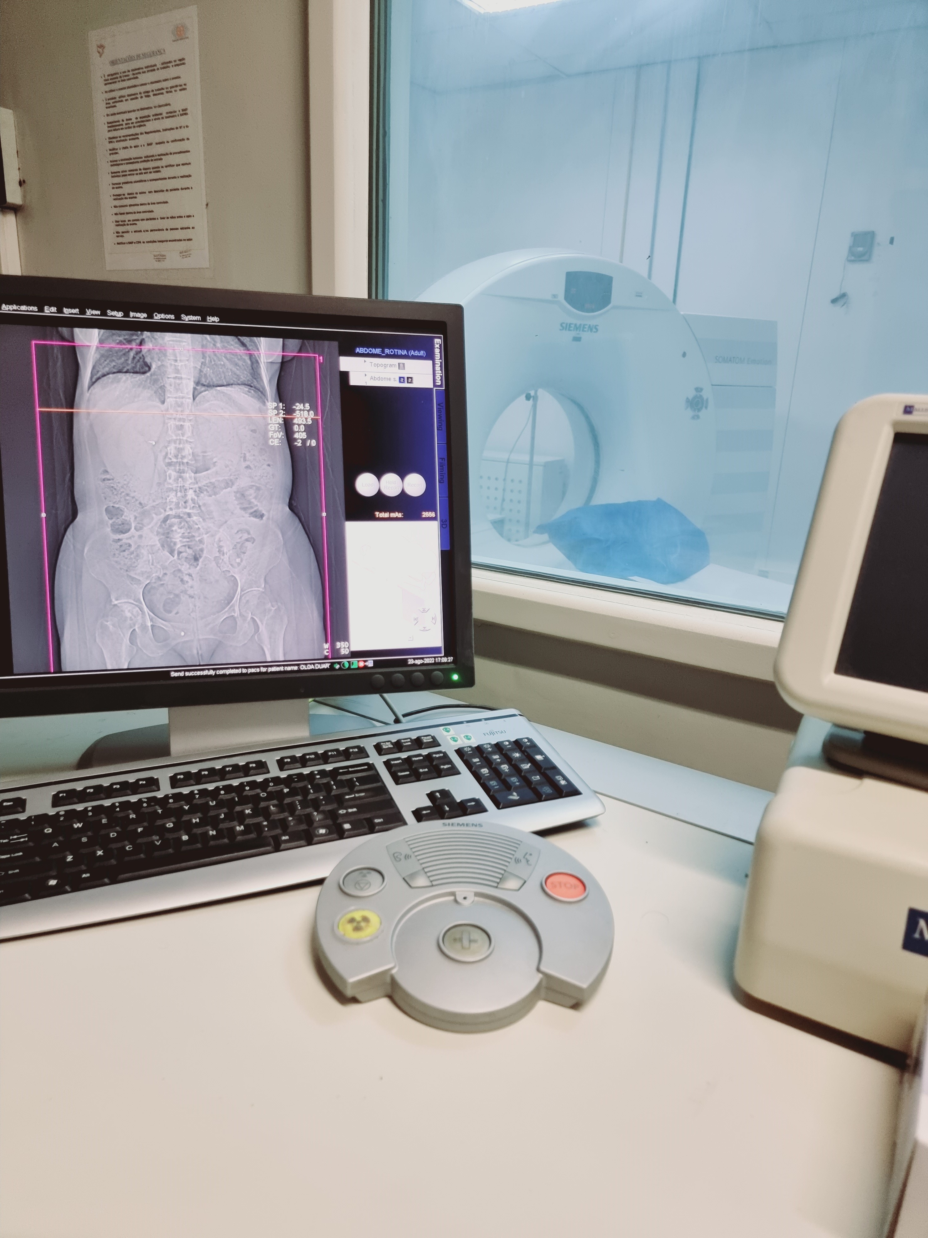 Visao de Rx. USMLE - USMLE RAD | Hotmart