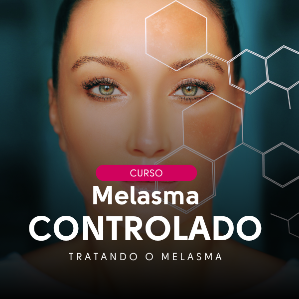 Curso Melasma Controlado - NK Cursos Online | Hotmart