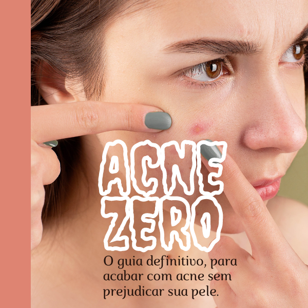 Acne zero: O guia definitivo para acabar com acne sem prejudicar su...